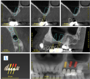 Shieh-Fig 4a - Oral Health Group