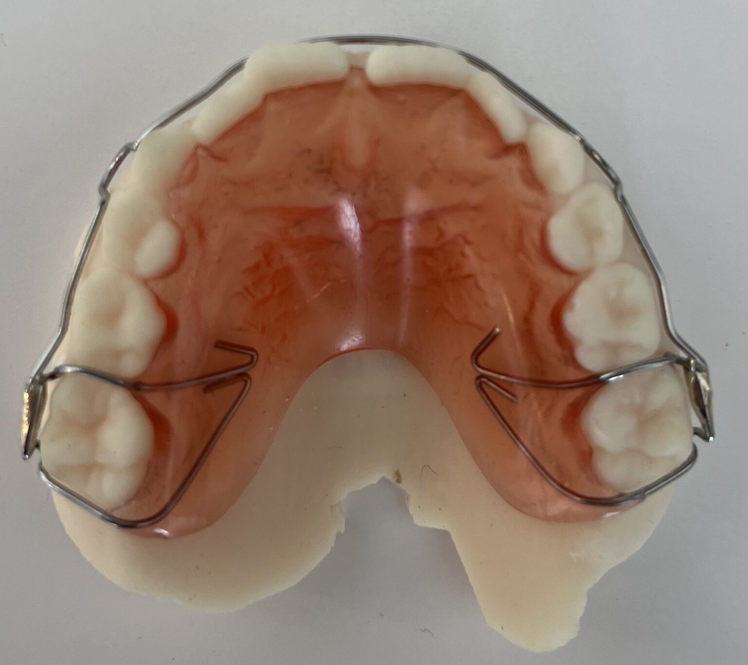 Retainers and the Importance of Orthodontic Retention