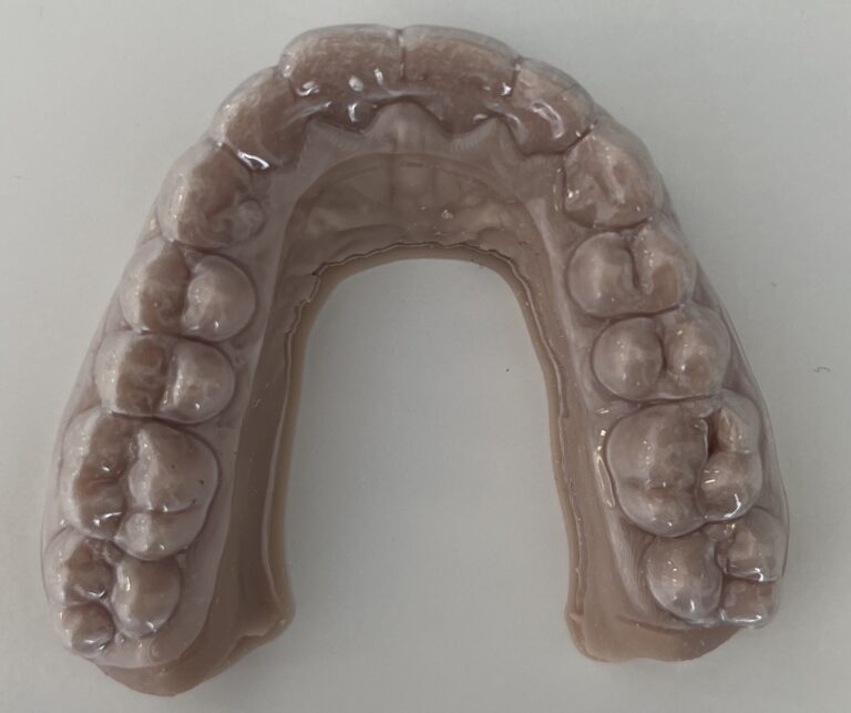 Retainers and the Importance of Orthodontic Retention