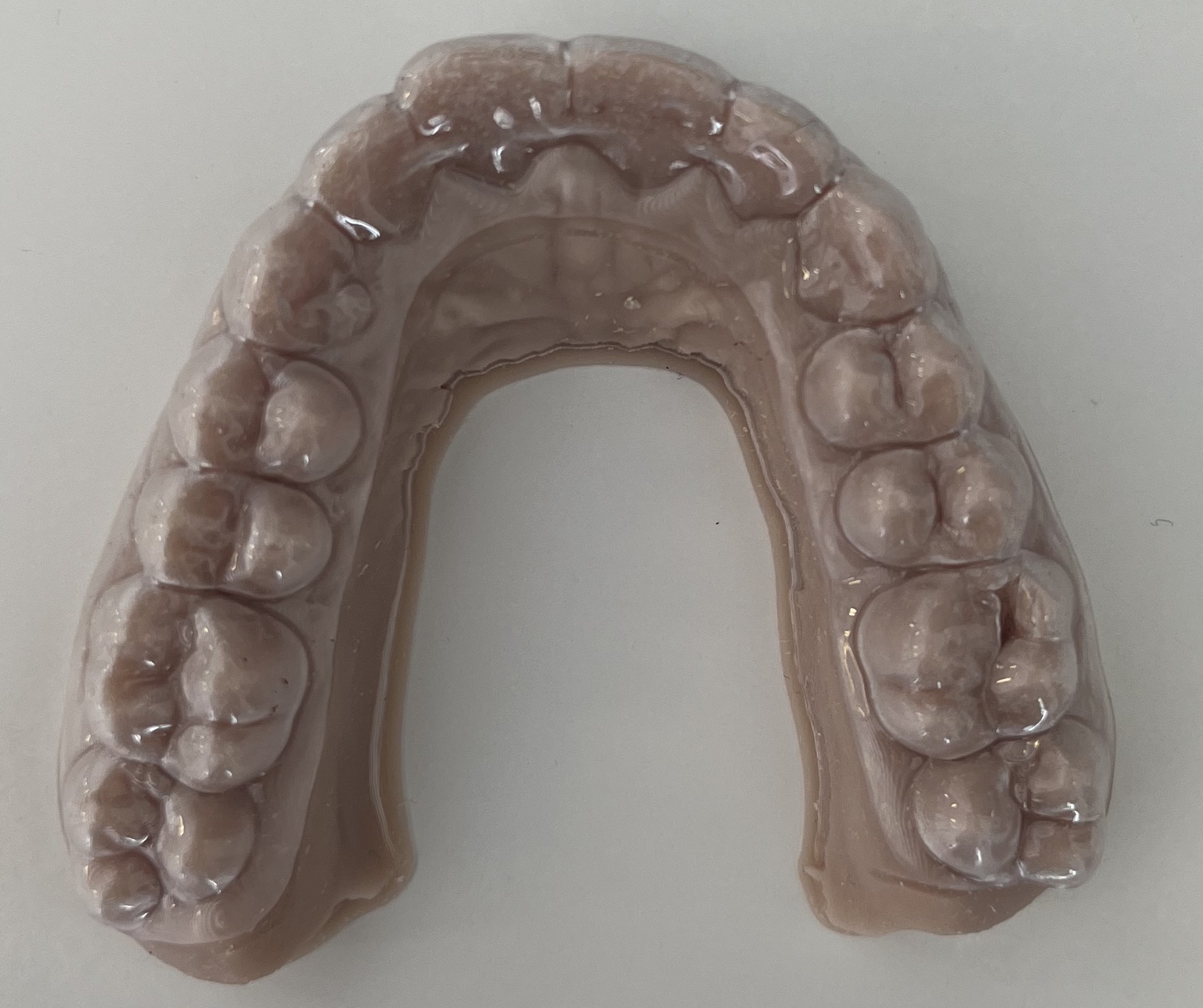 Retainers and the Importance of Orthodontic Retention