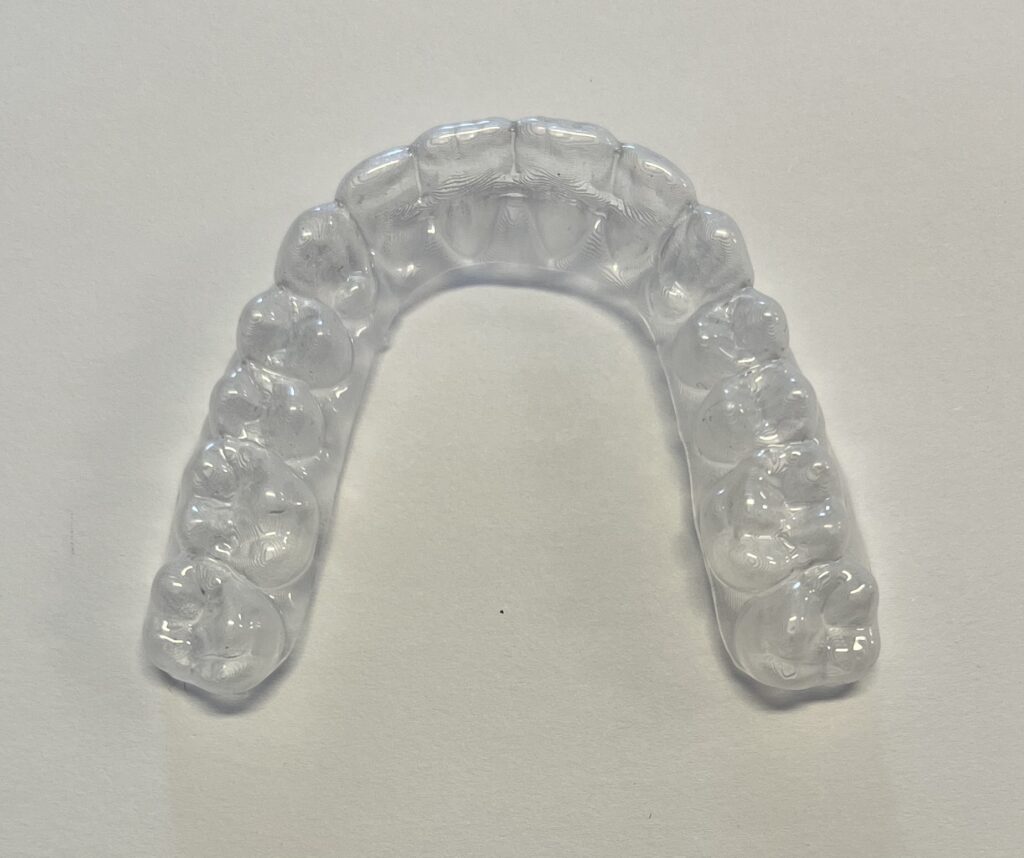 Retainers and the Importance of Orthodontic Retention