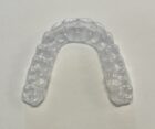 Retainers and the Importance of Orthodontic Retention