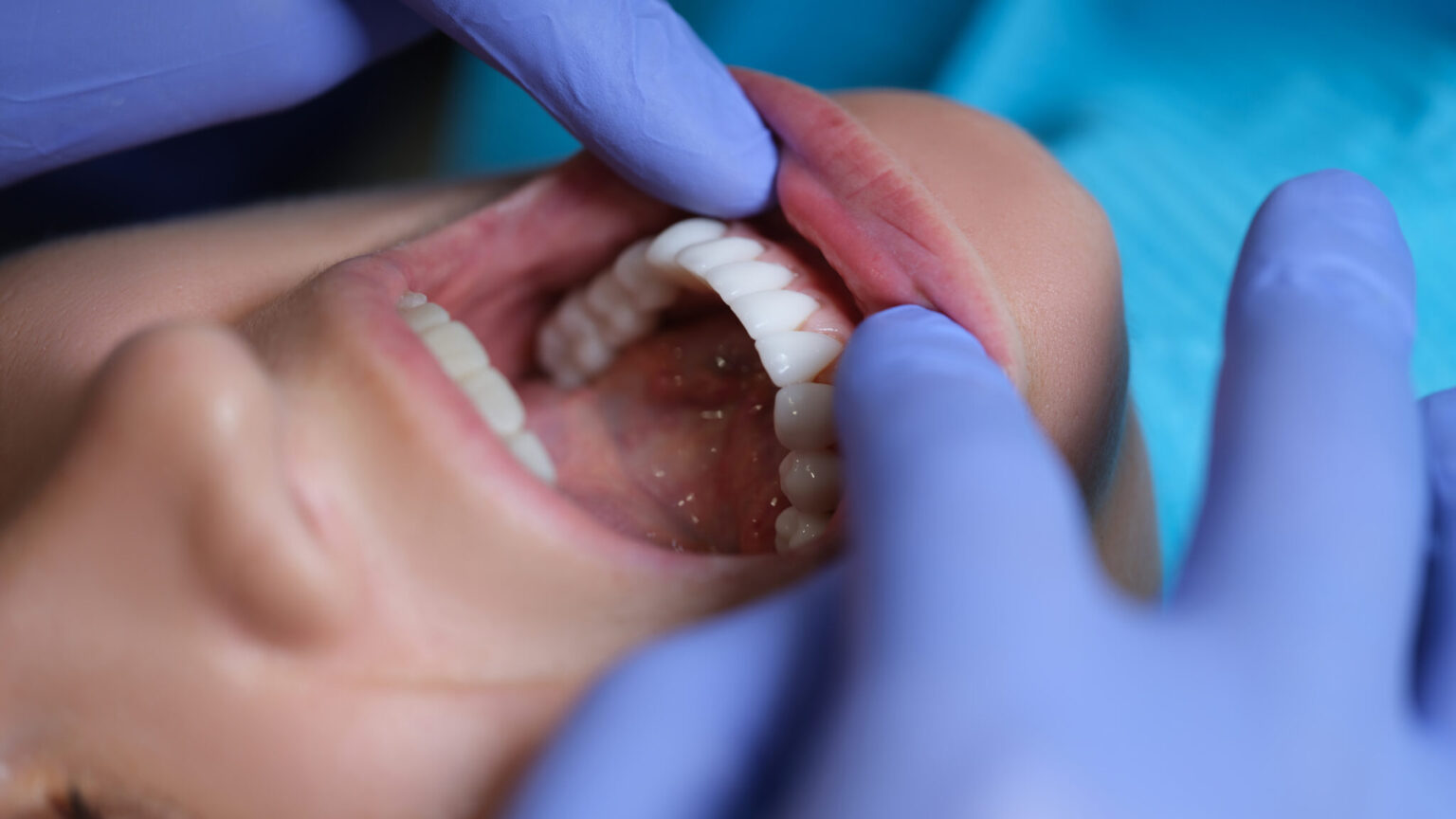 How Comprehensive is Your Comprehensive Oral Exam (COE)?