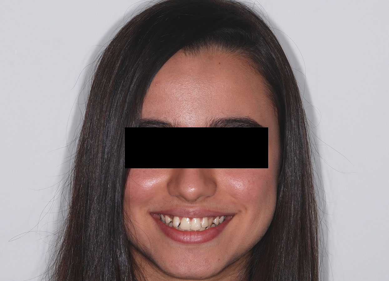 image1-chayah - Oral Health Group