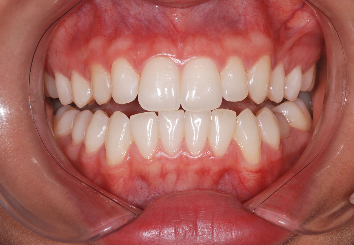 image26 - Oral Health Group