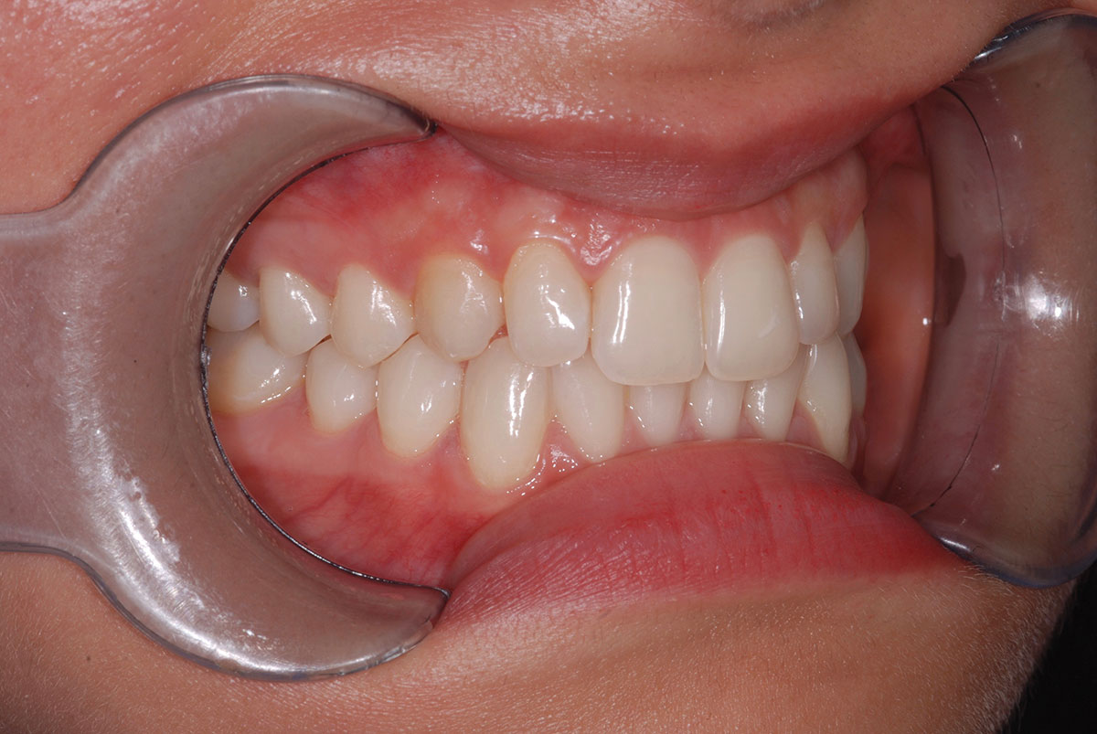 image32 - Oral Health Group