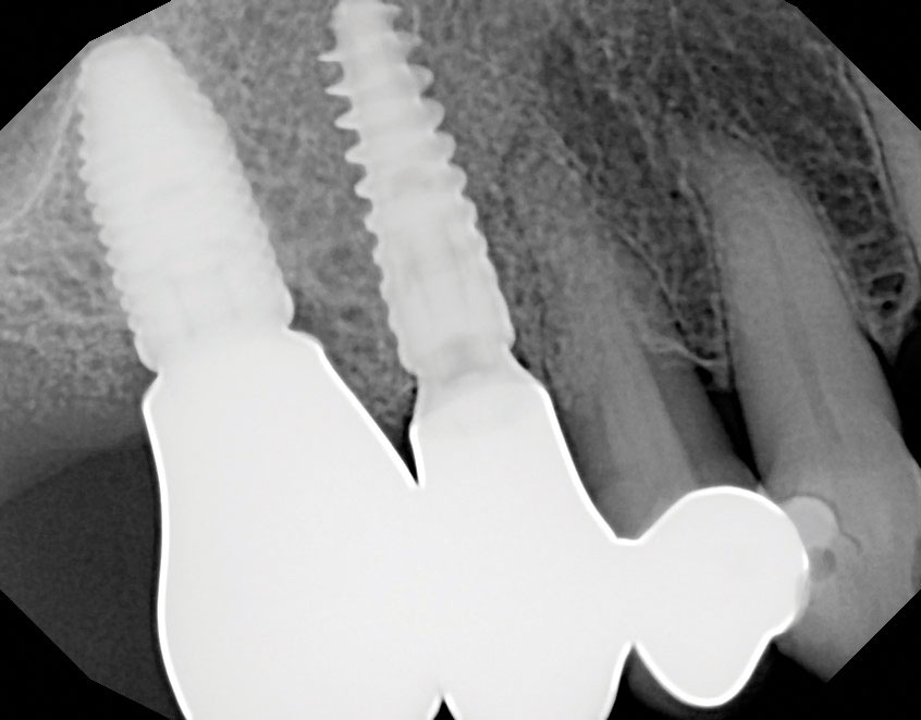 Birdi-Fig-23 - Oral Health Group