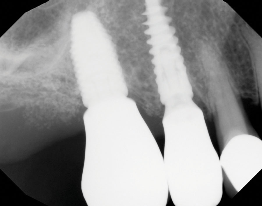 Birdi-Fig-25 - Oral Health Group