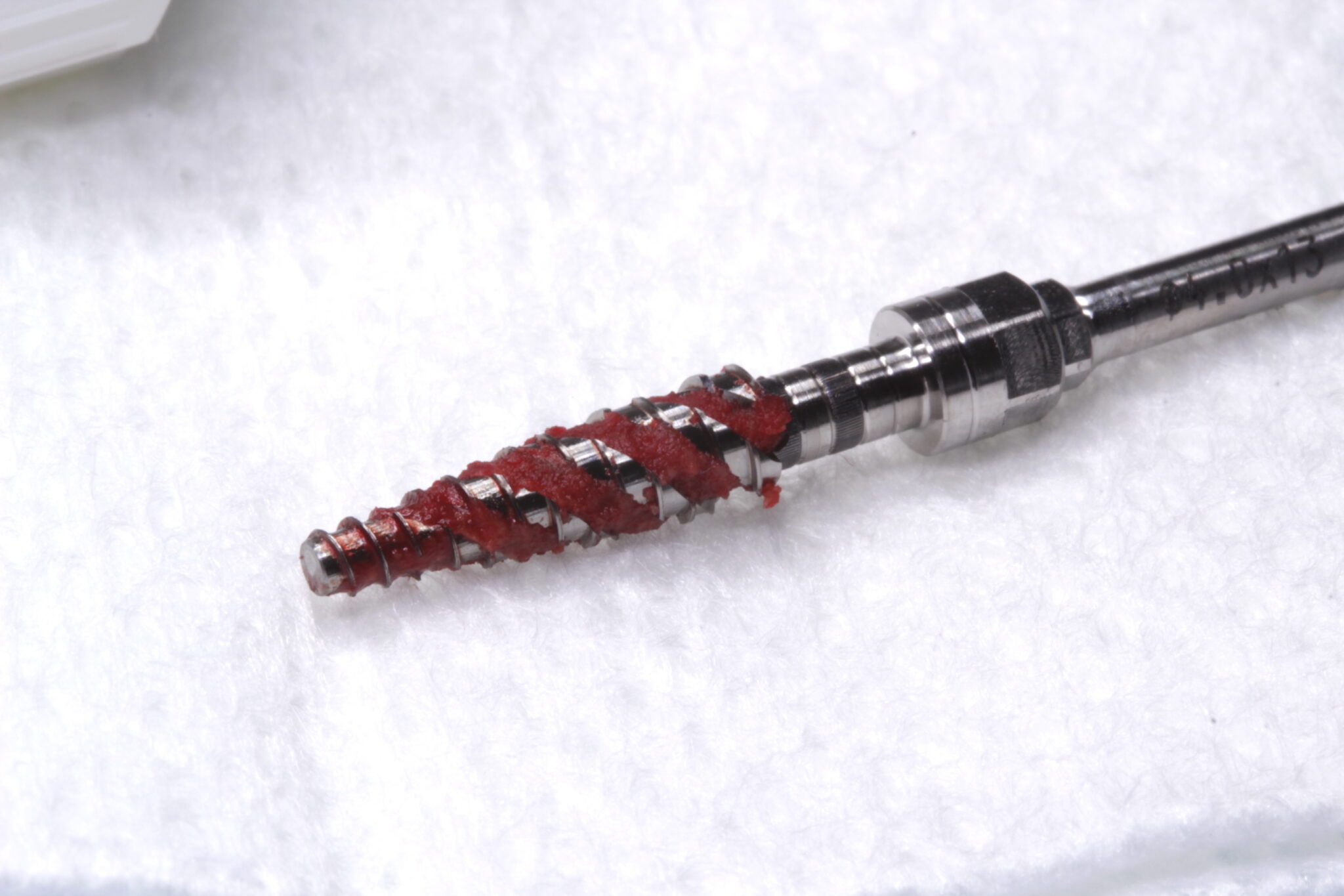 An Implant Osteotomy Paradigm Shift – Benefits of Minimally Invasive ...