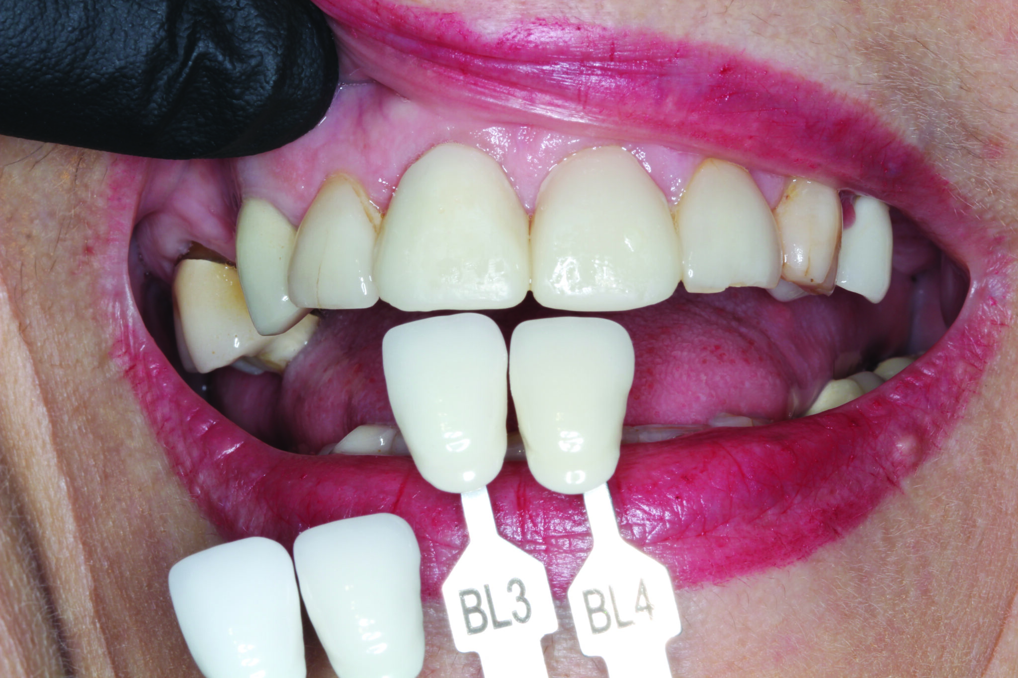 Fig08 - Oral Health Group