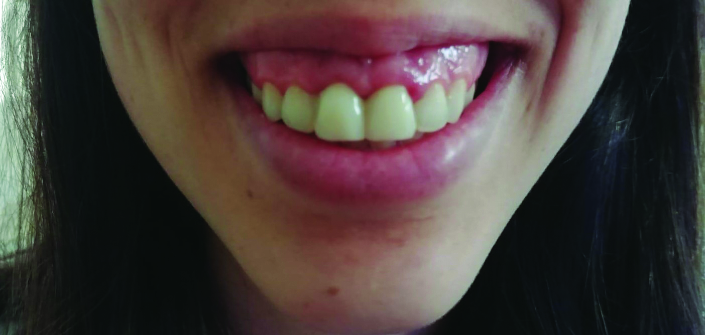 Raviv-1 - Oral Health Group