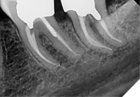 The Lateral Puff in Endodontics: Clinically Significant or a ...
