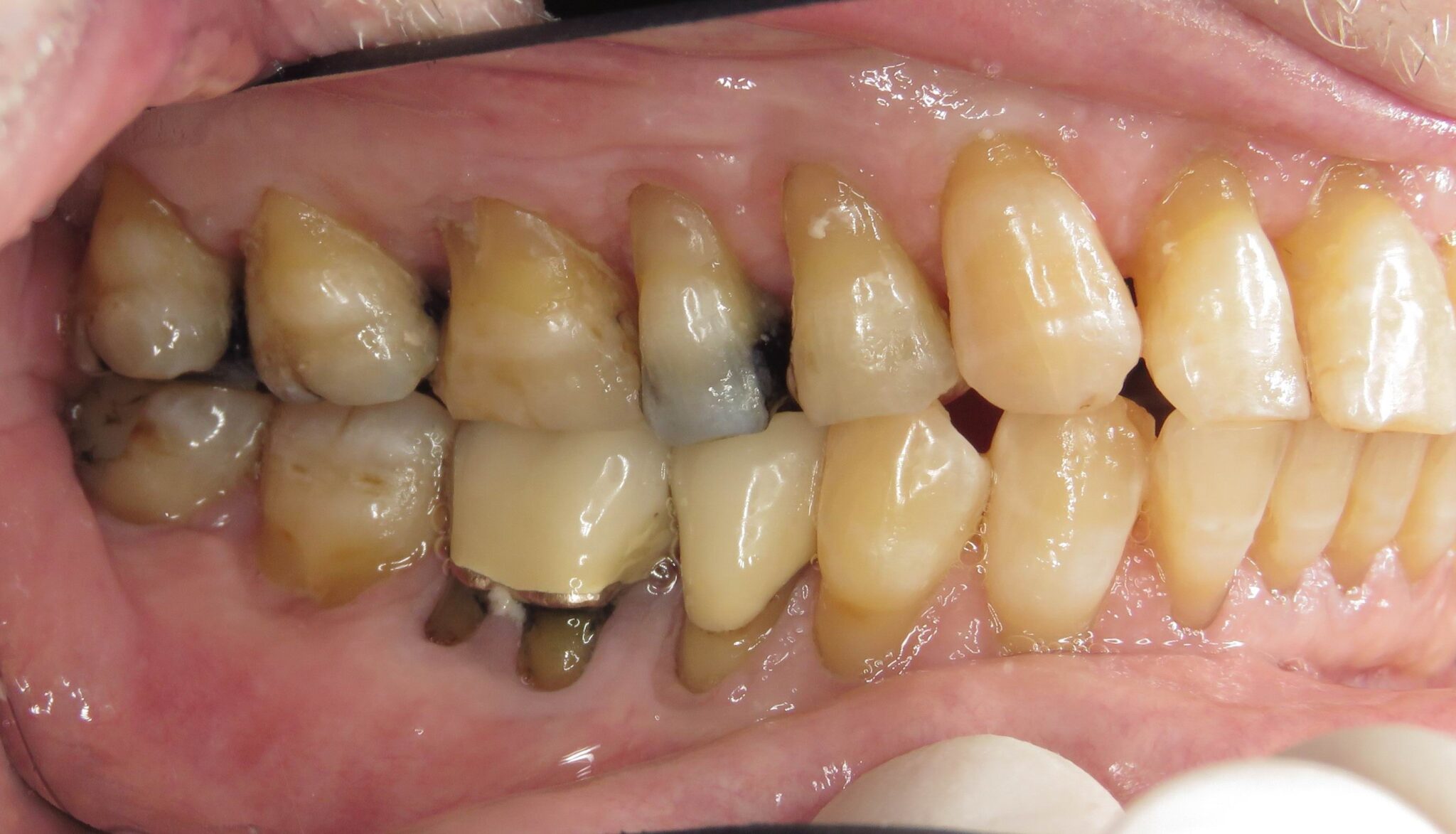 Somatic Symptom Disorder: Treating the Untreatable - Oral Health Group