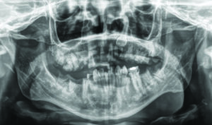 Pynn_Fig3 - Oral Health Group