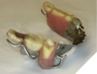 Multidisciplinary approaches to restoring vertical dimension of ...