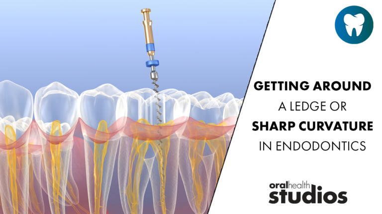 The Lateral Puff in Endodontics: Clinically Significant or a ...