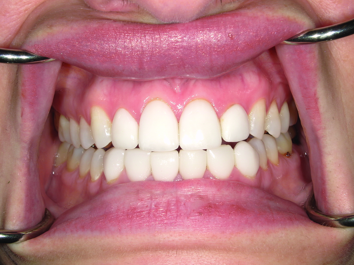 SHOFU DENTAL DIGITAL CAMERA - Oral Health Group