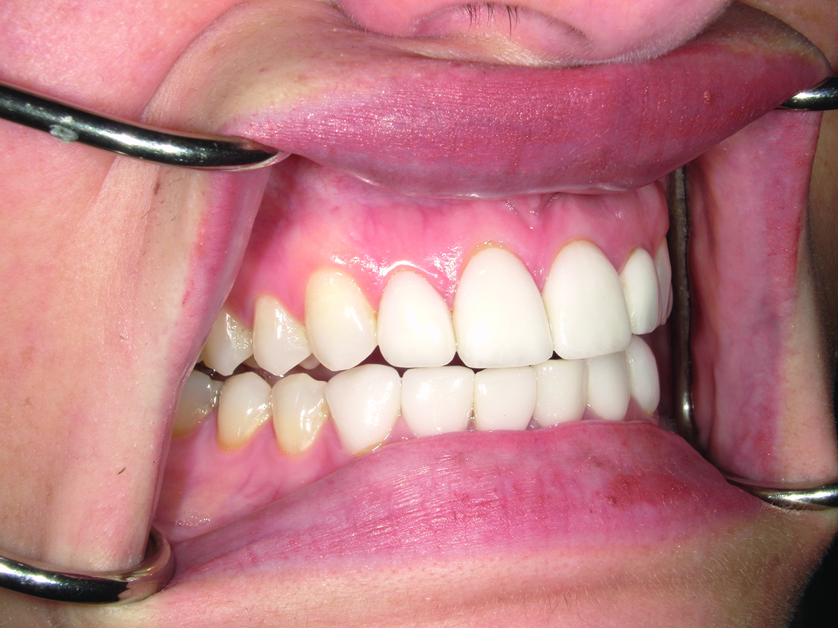 SHOFU DENTAL DIGITAL CAMERA - Oral Health Group