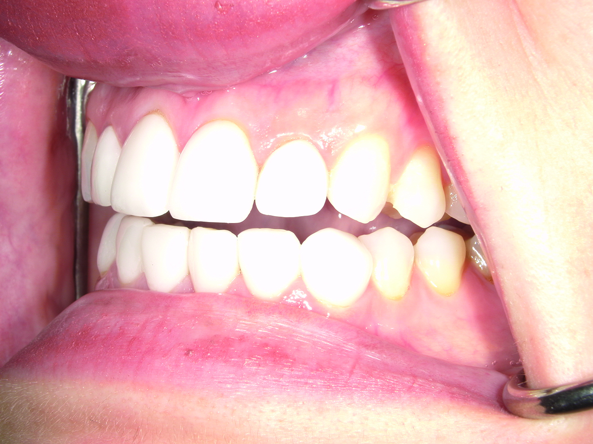 SHOFU DENTAL DIGITAL CAMERA - Oral Health Group