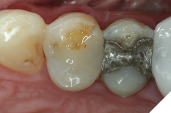 Lowe-Fig_2 (1)333333333333 - Oral Health Group