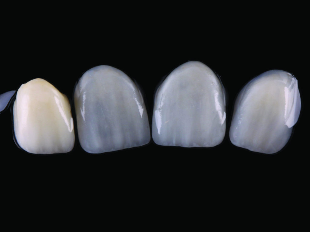 The importance of creating an illusion for malpositioned teeth - Oral ...