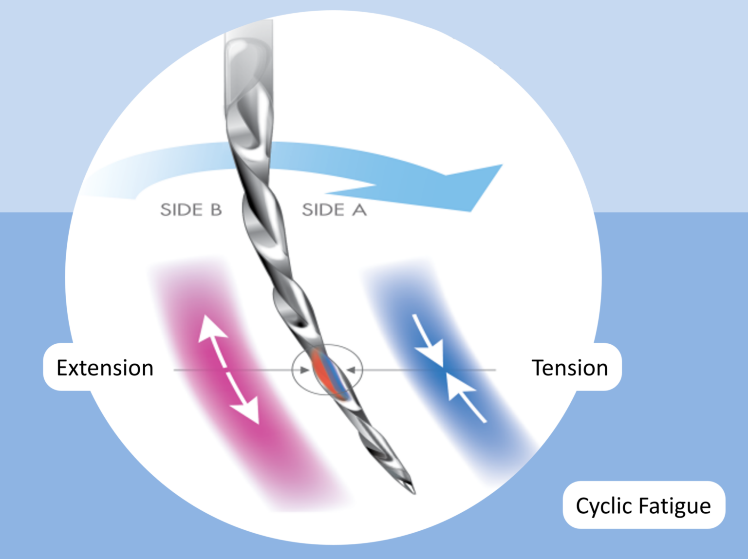 The multi-phase heat-treated file: Safeguarding against breakage of ...