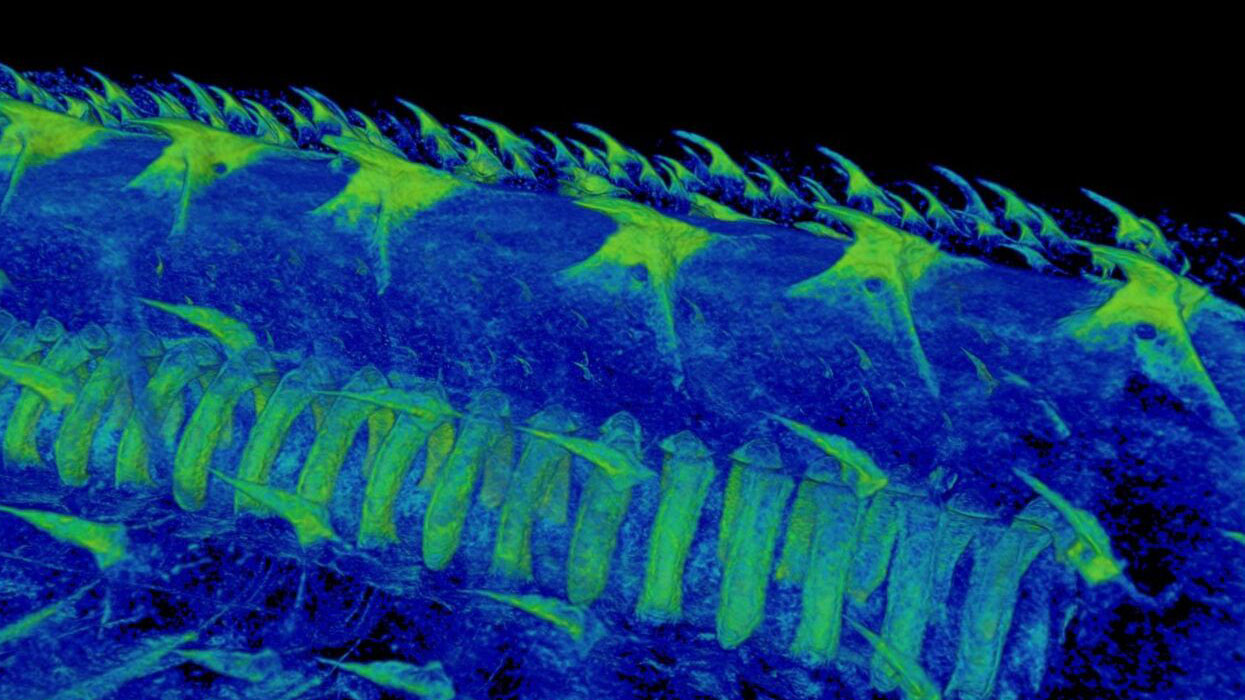 Human tooth sensitivity may have roots in ancient fish armor from over ...