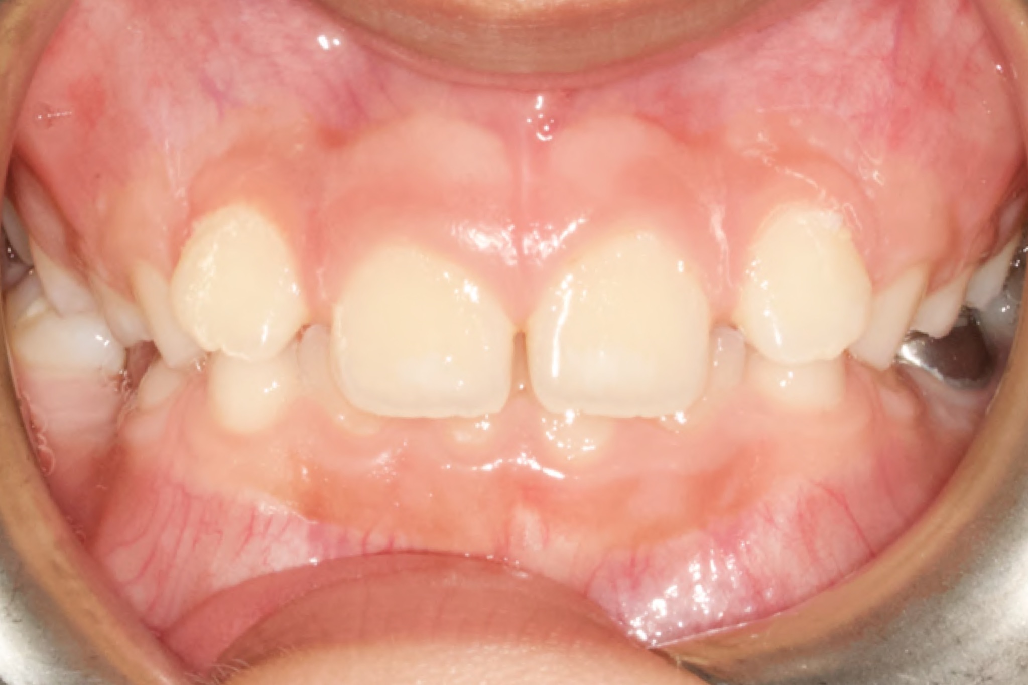 Figure 11a - Oral Health Group
