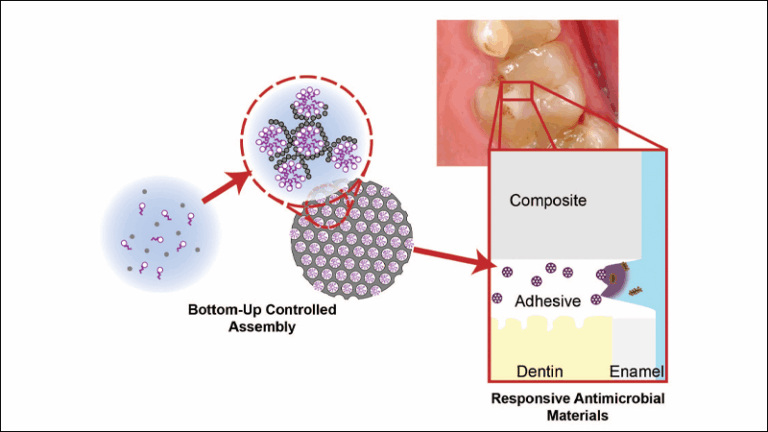 Bioactive breakthroughs: The next generation of antimicrobial dental ...