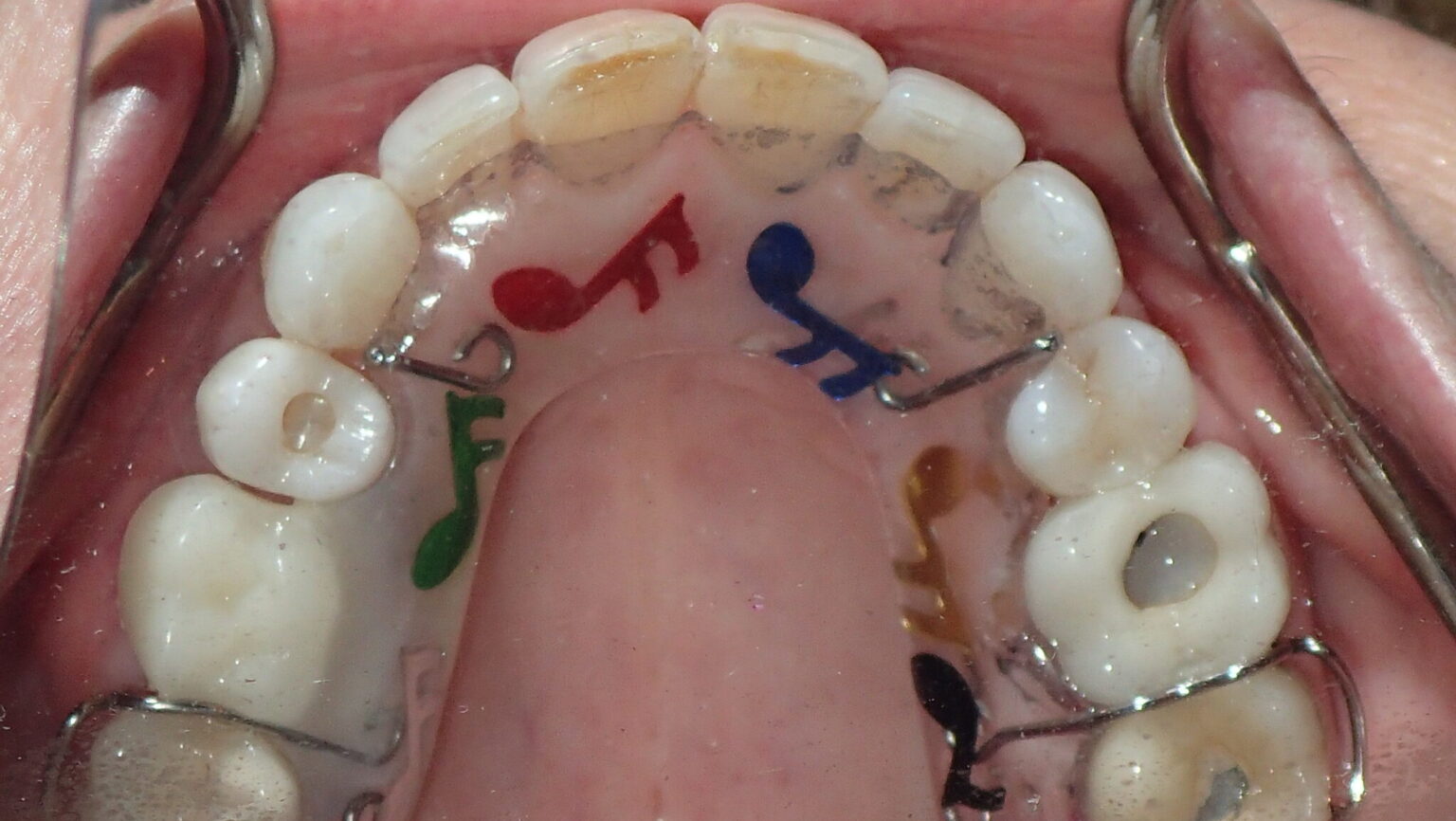 Sustaining the smile: The role of the general dentist in retention and ...