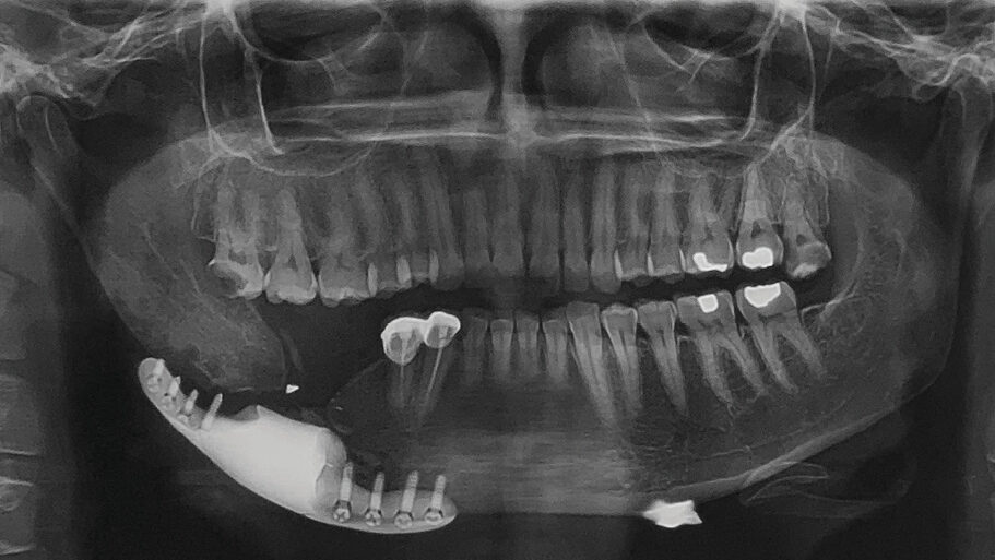 If you had to build a surgical mission in a war zone - Oral Health Group